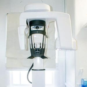 3D CBCT Scan available at Fendalton Dental Surgery